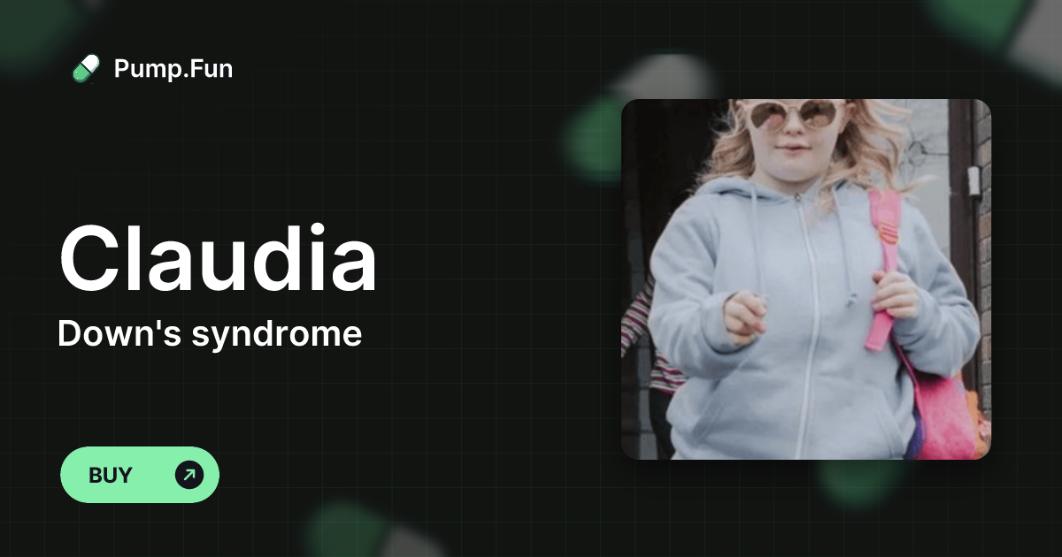 Down's syndrome (Claudia) - Pump