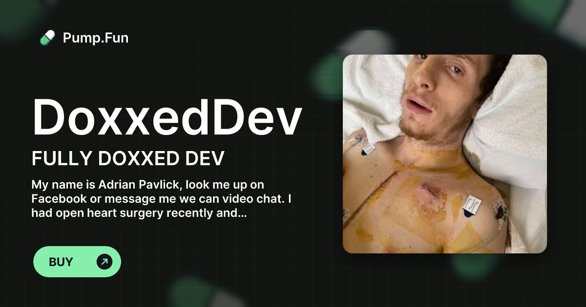 FULLY DOXXED DEV (DoxxedDev) - Pump